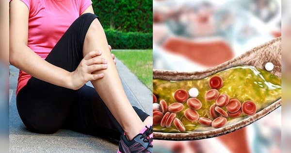 Body gives 5 High Cholesterol Warning Sign Before Attack Chest Foot ...