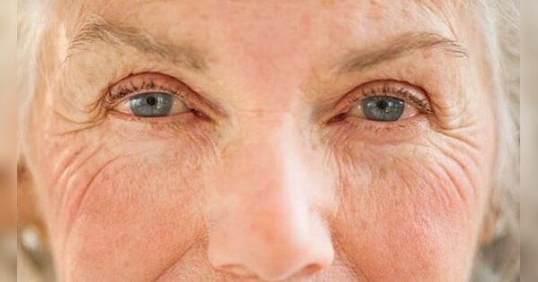 Wrinkle Cure Diet Tips to look young and ways to remove wrinkles ...