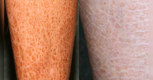 winter skin care routine for glowing skin | ग्लोइंग स्किन के लिए ...