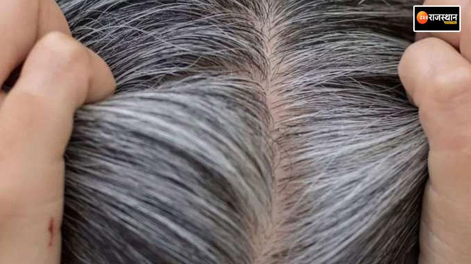 White Hair Solution Home Remedies Follow these easy tips to get rid of ...