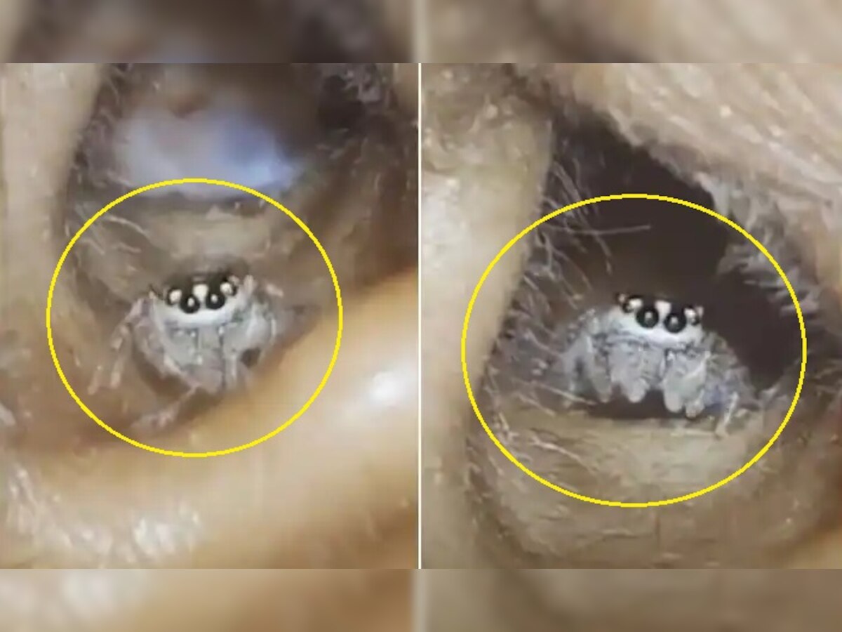 shocking video of little spider raoming inside the ear of woman on ...