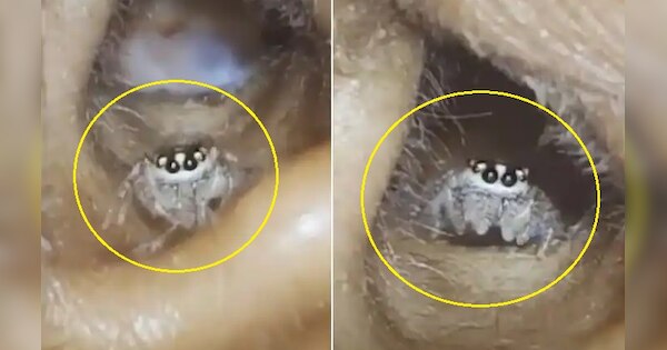 shocking video of little spider raoming inside the ear of woman on ...