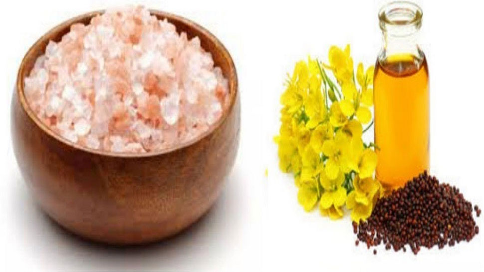 Kriti Sanon Smile How To Get Rid Of Yellow Teeth Whitening Mustard Oil ...