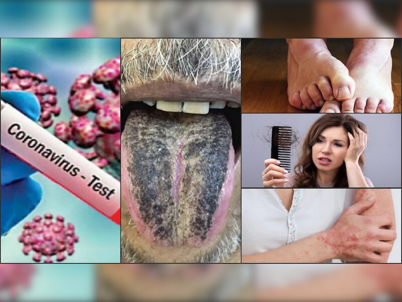 Coronavirus bf7 Variant dominant in China know 5 symptoms warning signs ...