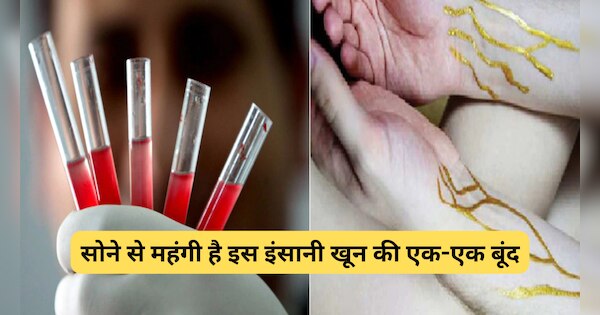 What is golden blood group and its specialty why Rh null blood group ...