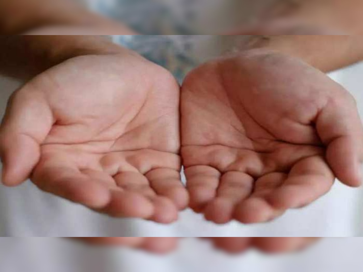 If you have yav sign on your thumb then you may have Wealthy life like ...