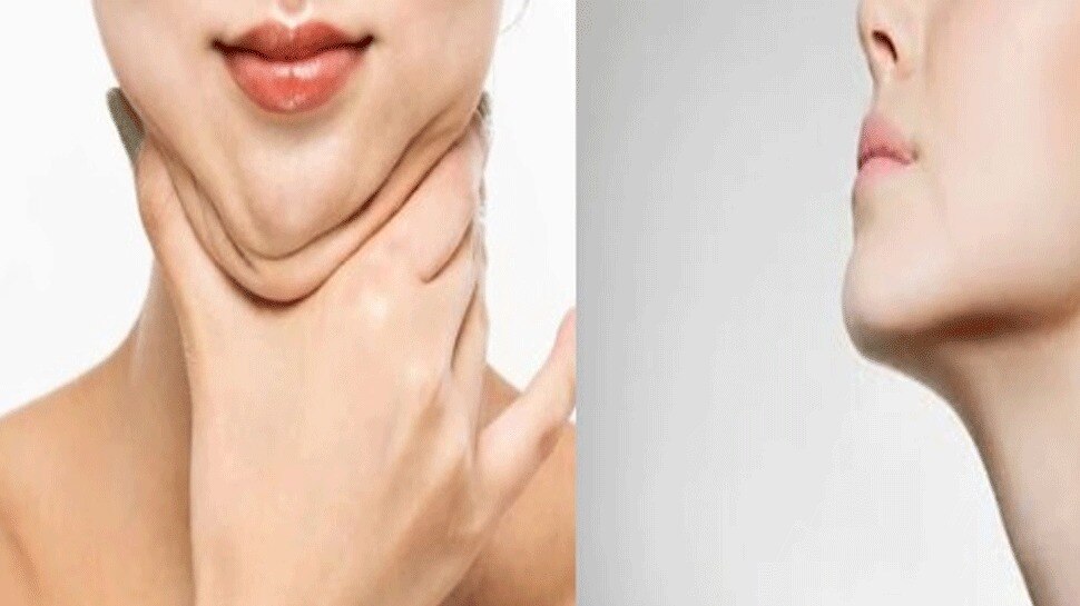 Double Chin removal tips how to remove double chin Exercise for women ...