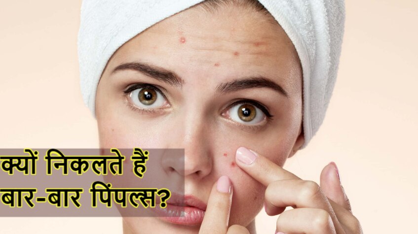 this is the main reason of pimples coming again and again on face leave ...