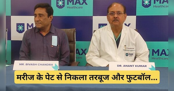 World biggest tumor treated at Delhi Max Hospital patient Biwash Tiwari ...