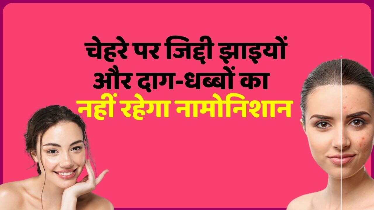 Beauty tips stubborn freckles and spots apply this pack on face ...