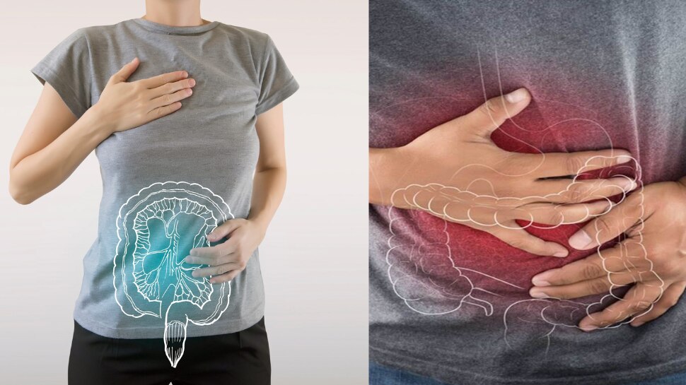 how to identify colorectal cancer early screening symptoms treatment ...