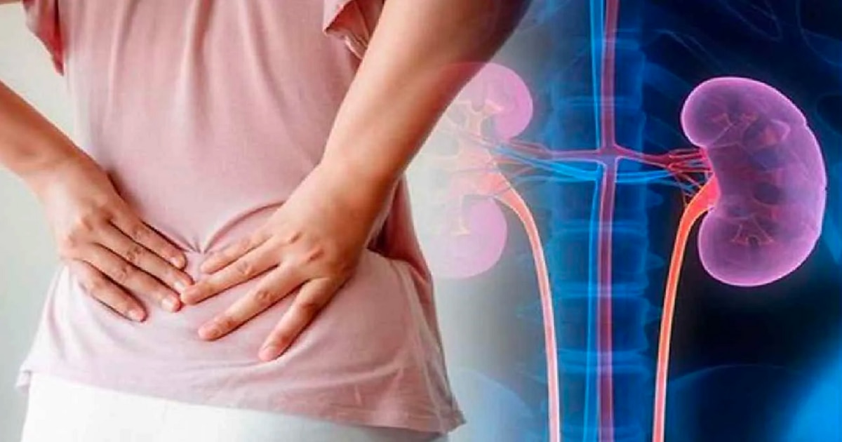Health tips: These are all the symptoms of kidney stones that everyone ...