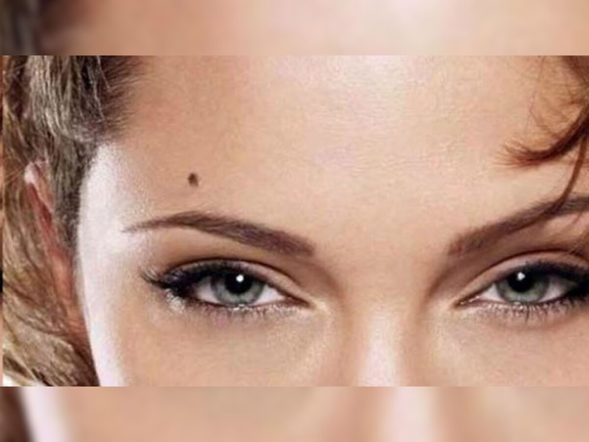 Lucky Moles People with moles in this part of body become millionaires ...