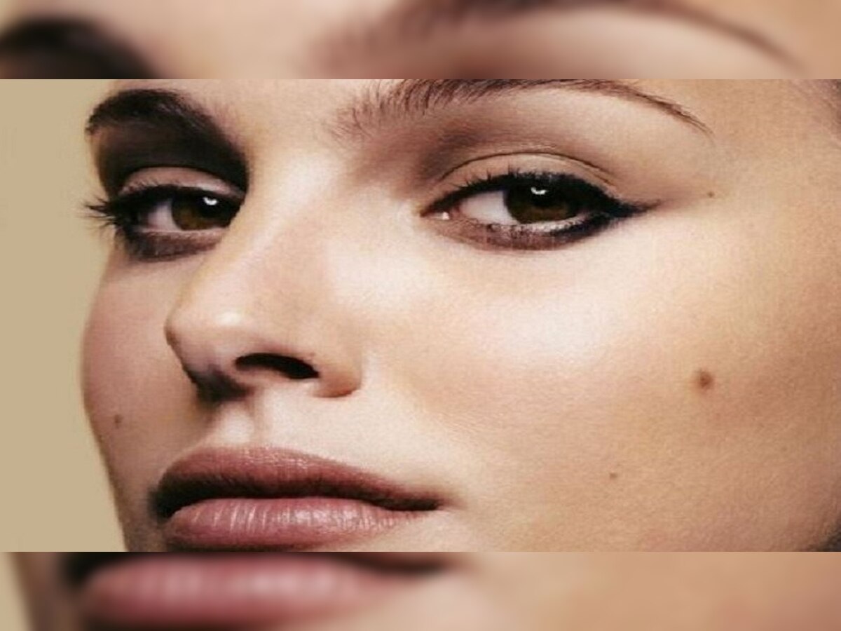 Lucky moles people with moles in this body part become millionaires ...