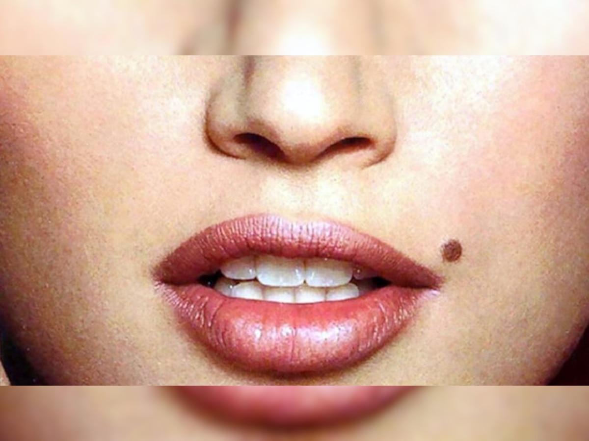 Lucky moles people with moles in this body part become millionaires ...