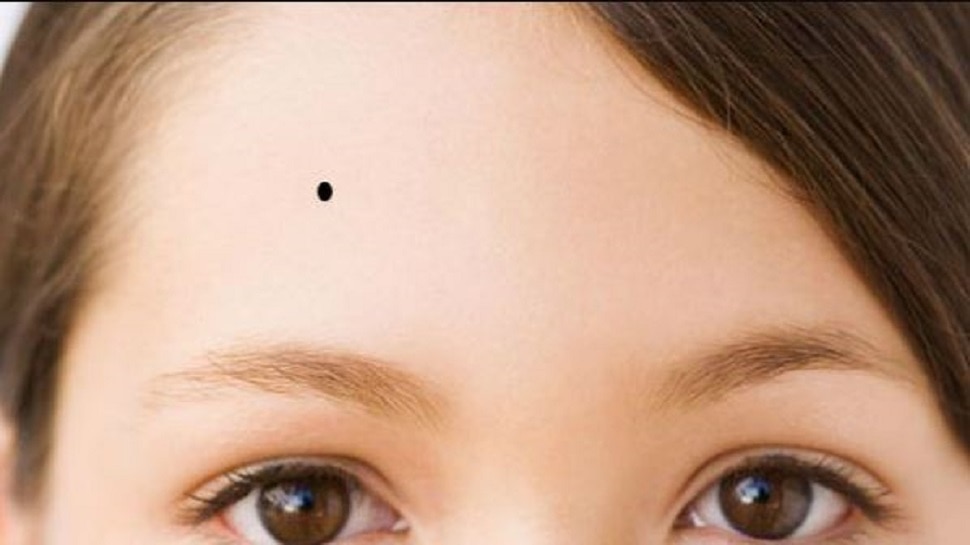 Lucky moles people with moles in this body part become millionaires ...