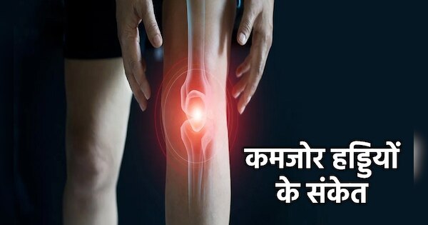 Weak bones symptoms: do not ignore these 5 signs of weak bones | Signs ...