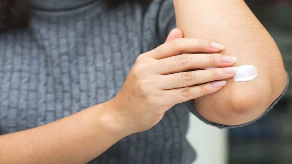 How to lighten dark knees and elbows try these amazing tips for ...