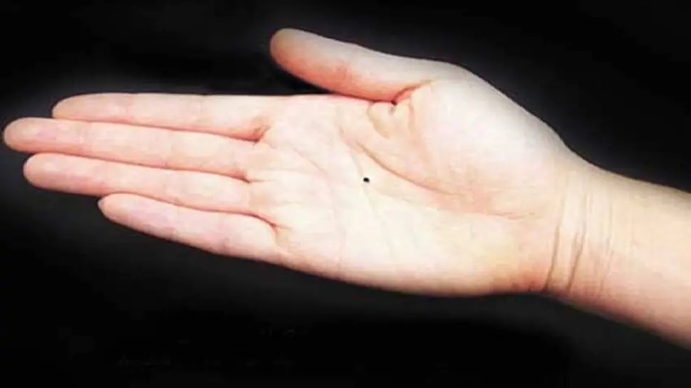 Mole on Hand: करोड़पति बनाता है हथेली की इस जगह पर बना तिल! जल्‍दी से ...