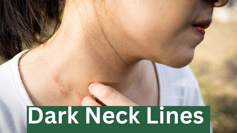 Dark Circles On Neck Line could be Warning Sign Of Prediabetes Never ...
