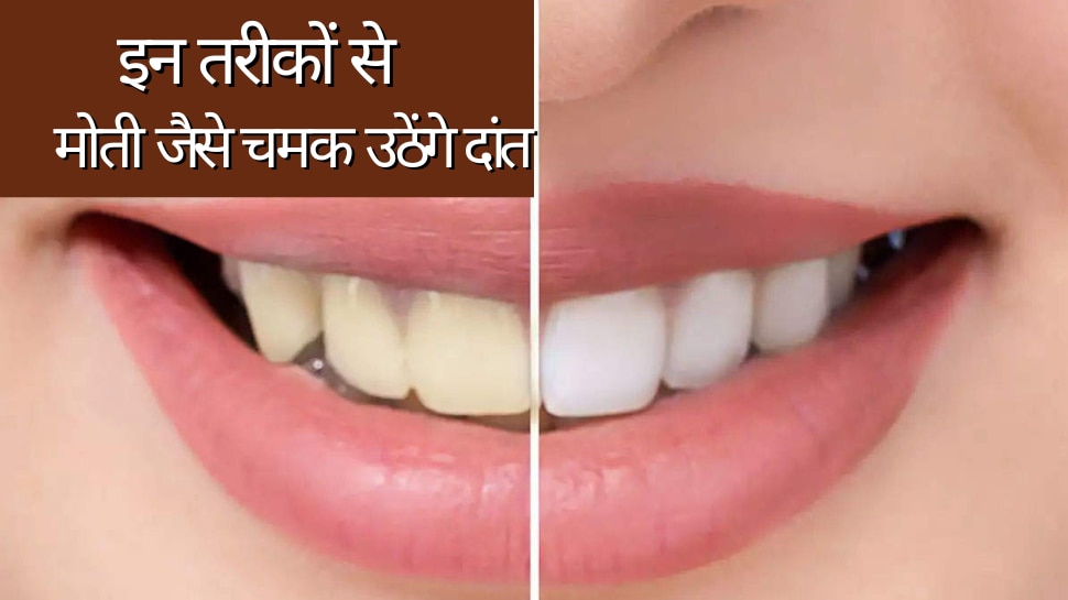 How To Clean Teeth Home Remedies Bad Breath Problem Teeth Cleaning