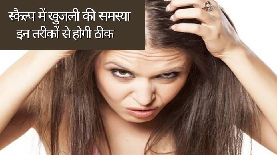 hair care tips problem of itching in the scalp will be cured by these ...