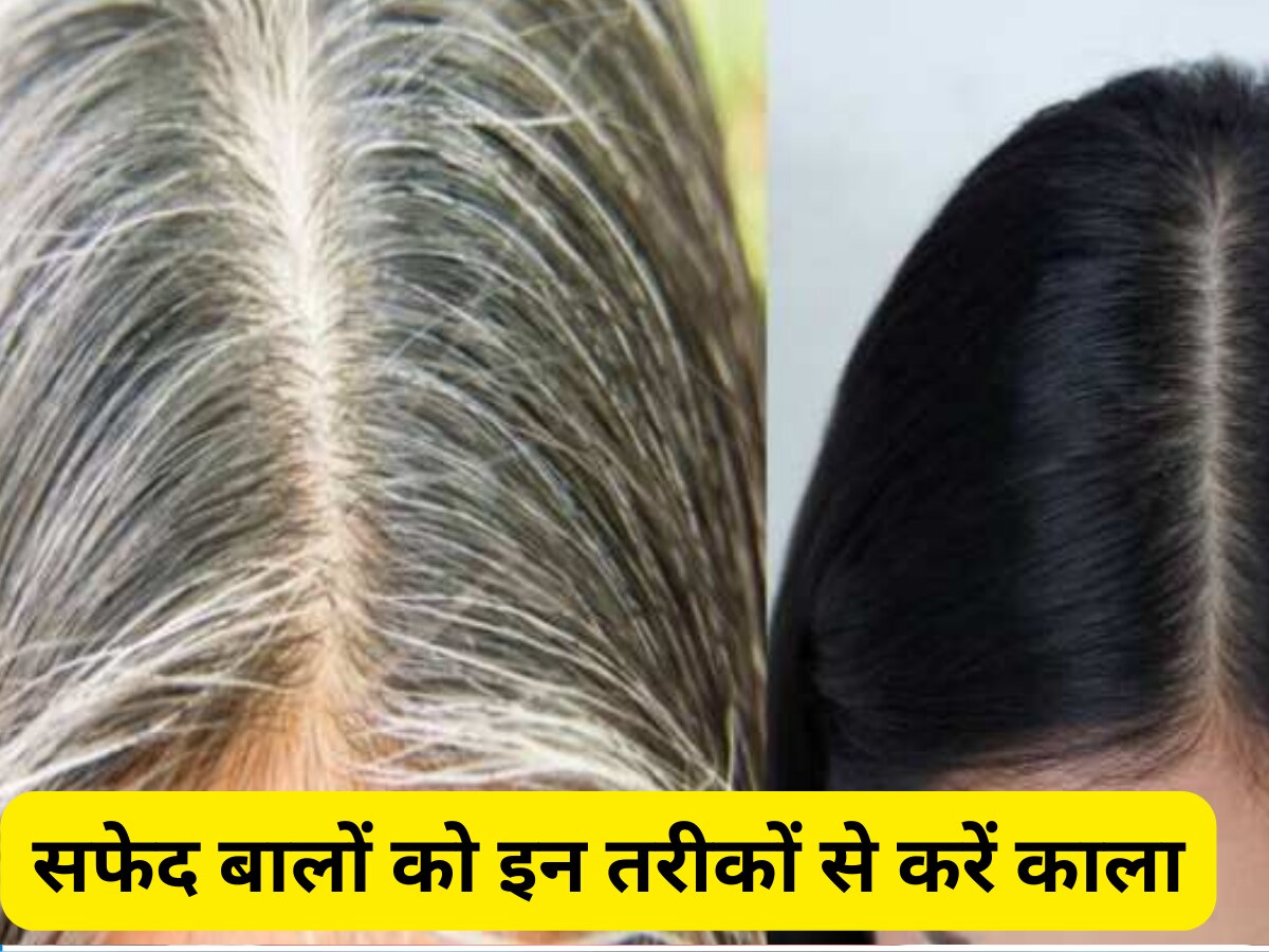 White Hair Problem Home Tips Onion Cow Milk Black Pepper Aloe Vera Gel ...