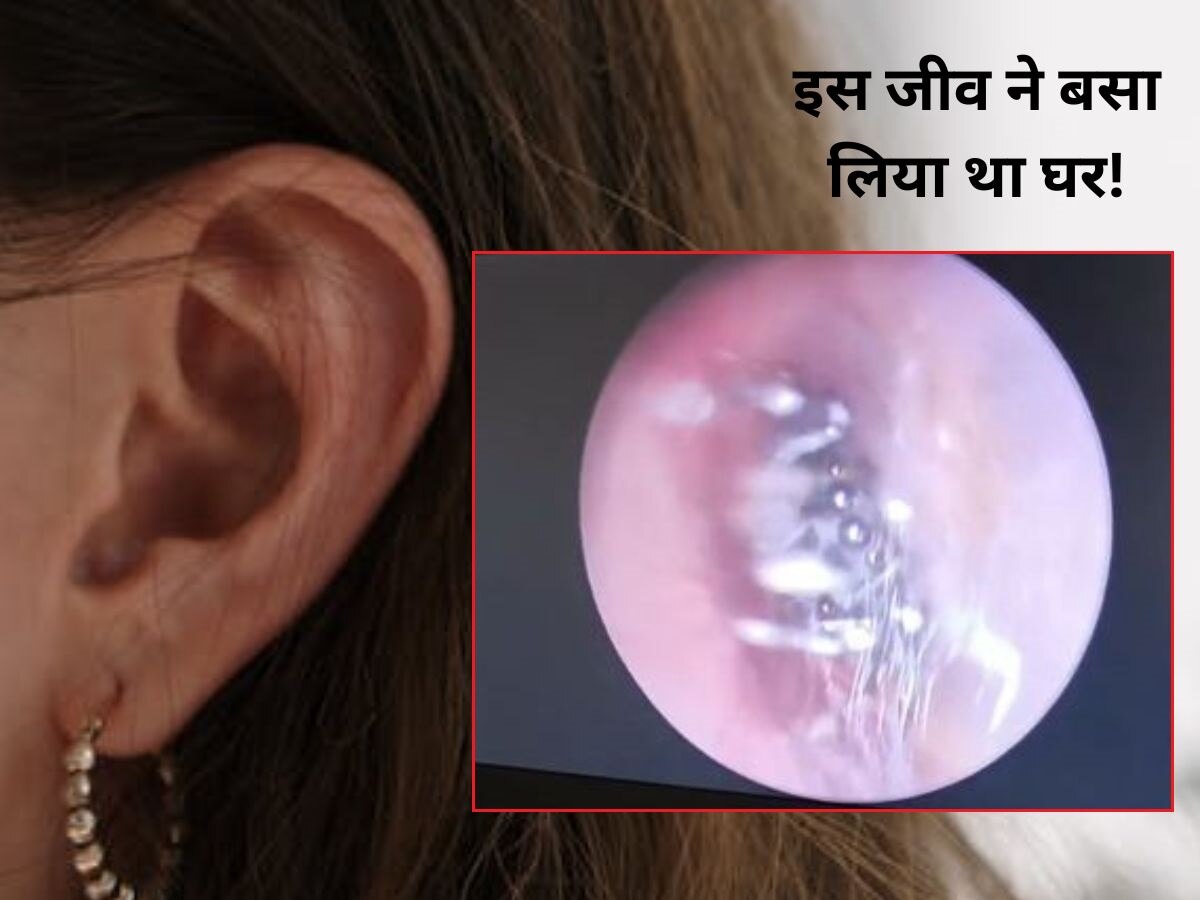 spider web with buzzing sound inside womans ear doctor removed महिला के ...