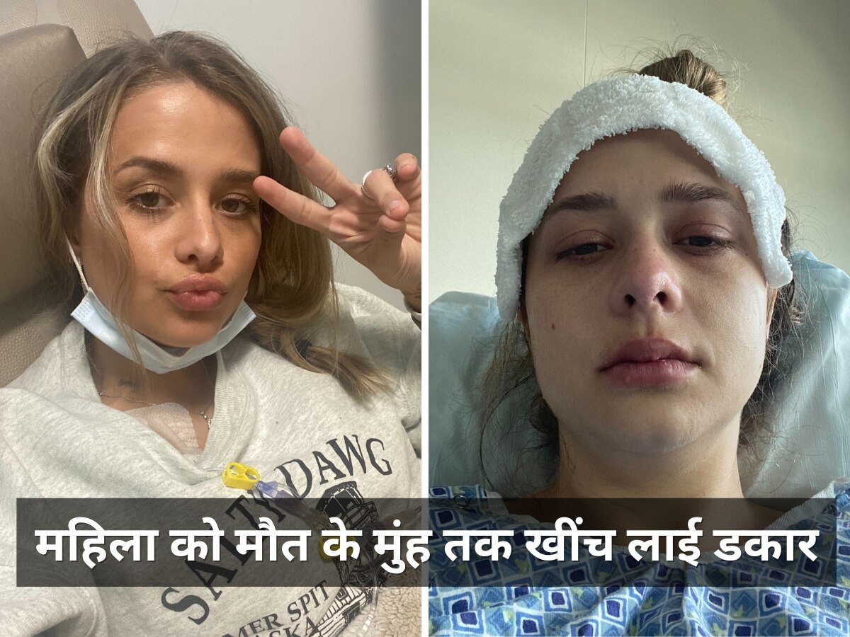 Shocking! 24 year old woman was having burping for years get diagnosed ...