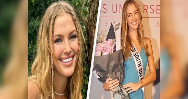 Miss universe finalist Sienna weir Model passed away 23 after Horse ...