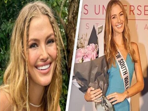 Miss universe finalist Sienna weir Model passed away 23 after Horse ...