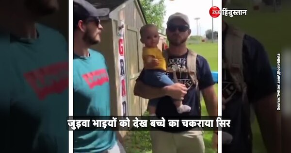 twin brothers child forehead dizziness went viral | जुड़वा भाइयों को ...