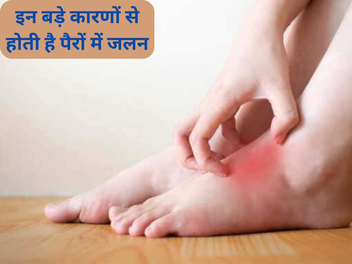 health tips burning sensation on the soles of the feet pairo ke talavo ...