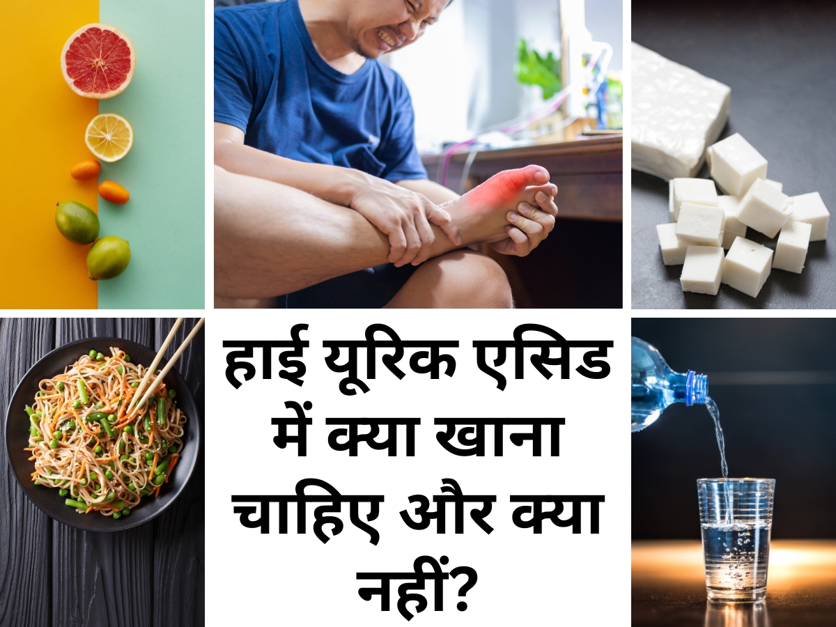 What To Eat And What Not To Eat When Uric Acid Level Is High Worst
