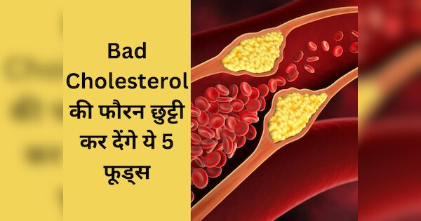 health tips these 5 foods will get rid of Bad Cholesterol immediately ...