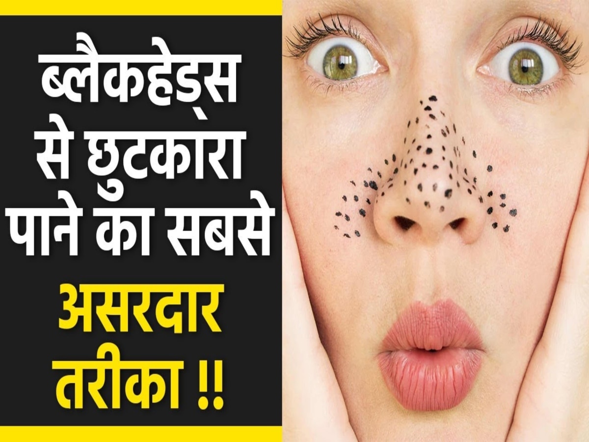 Blackheads Removal Mask Use Kheera Green Tea | Hindi News, फ्रिज में ...