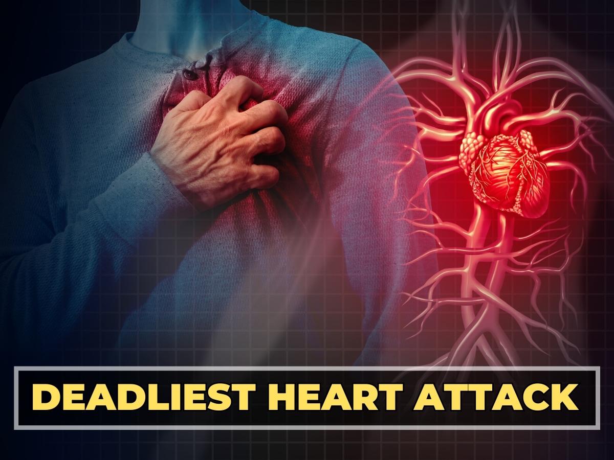 Monday Thursday or Saturday know on which day the Deadliest heart ...