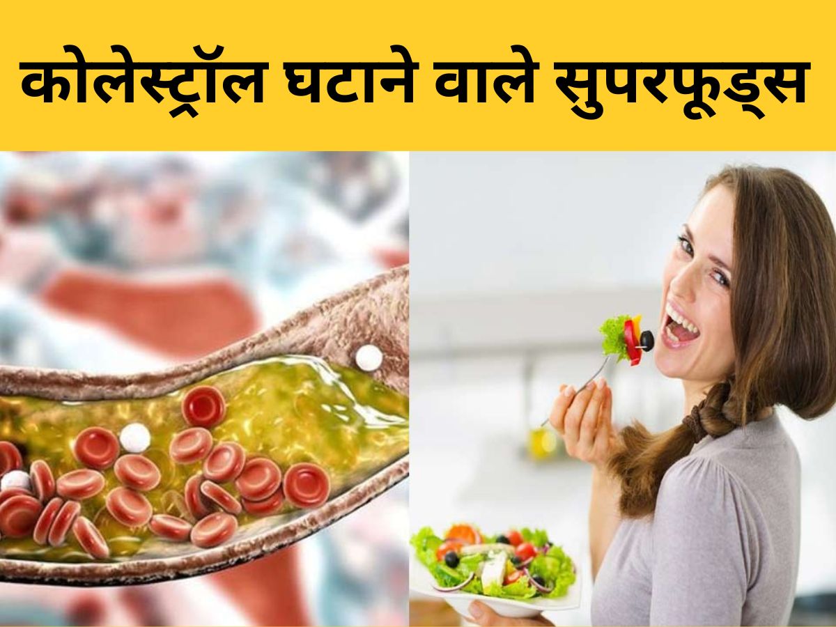 Top Ten Cholesterol Lowering Superfoods You Must Eat To Avoid Fat in ...