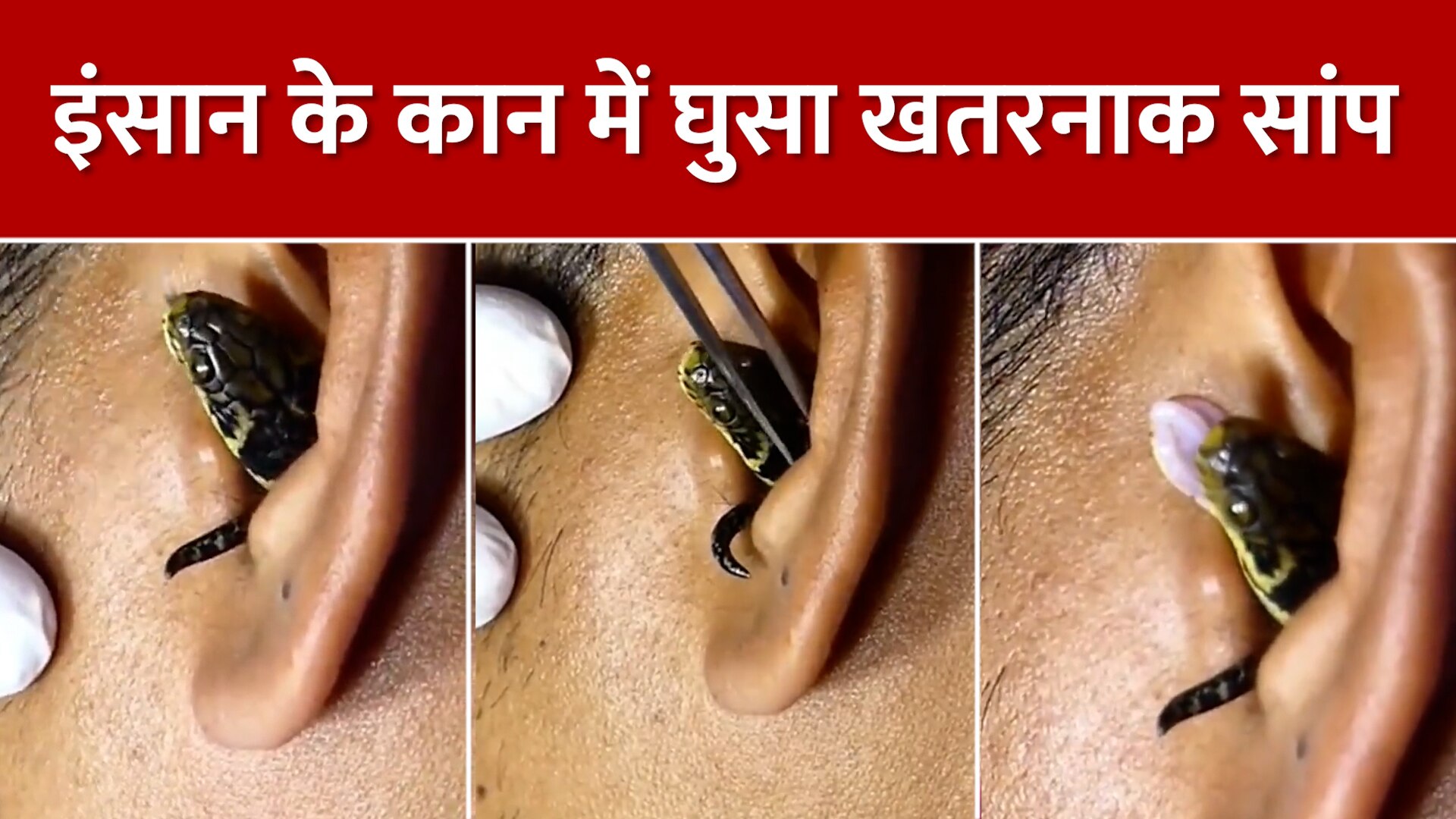 Viral video Dangerous snake enters man ear everyone watching was ...