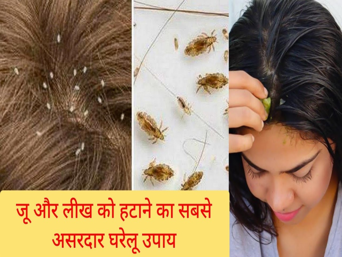 Home Remedies To Get Rid Of Lice Naturally Coconut Oil Camphor Hindi
