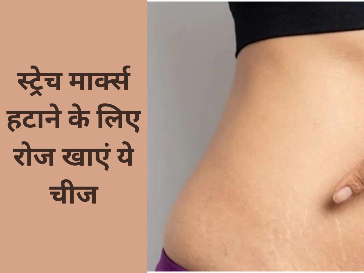 Health Tips Eat These Things Daily To Remove Stretch Marks Stretch