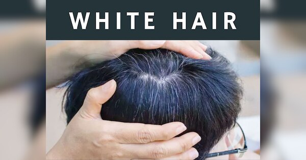 Foods that can Prevent Premature White Hair Problem at very young Age ...
