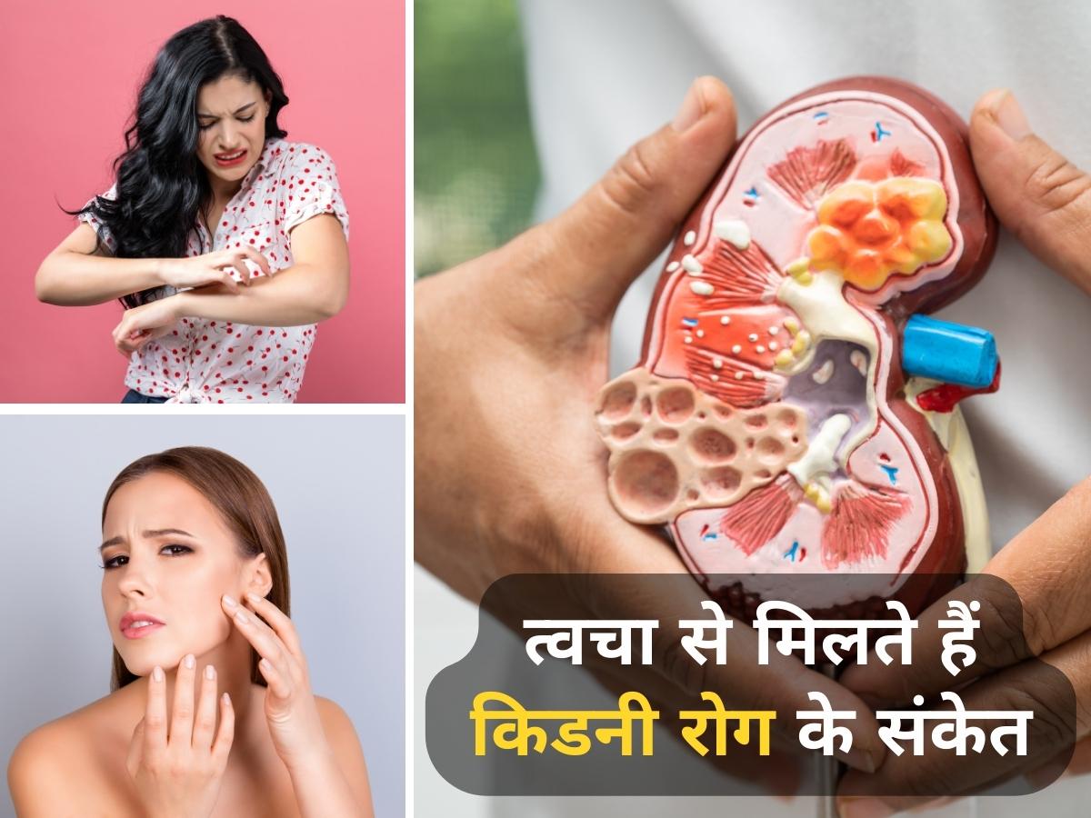 Kidney Disease: two changes happing on skin indicates warning sign of ...