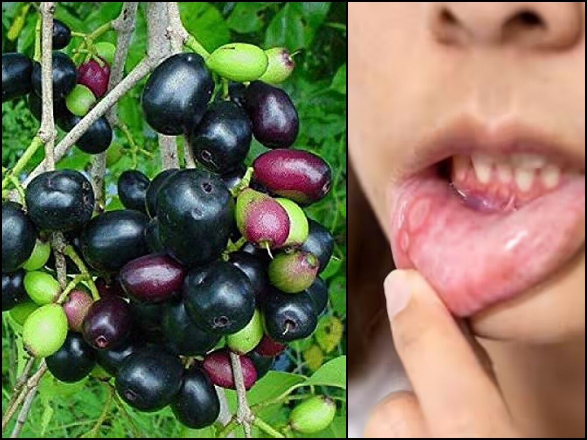 jamun ke fayde Cure 11 These Diseases health benefits of jamun in hindi | Jamun Ke Fayde: काले ...
