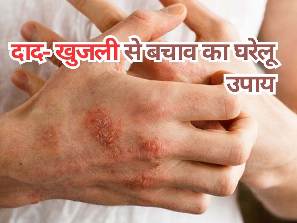 Skin Disease Mein Neem ke Fayde neem remedy for itching |Skin Disease ...