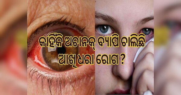 Eye Flu: Causes, symptoms and preventions
