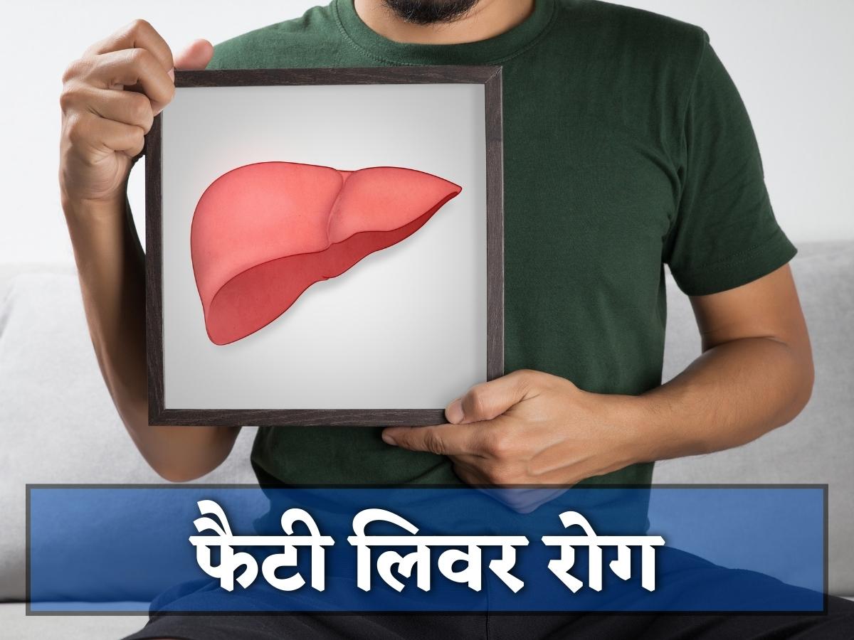 Know 5 Common Causes Of Fatty Liver Disease Then There Will Be No