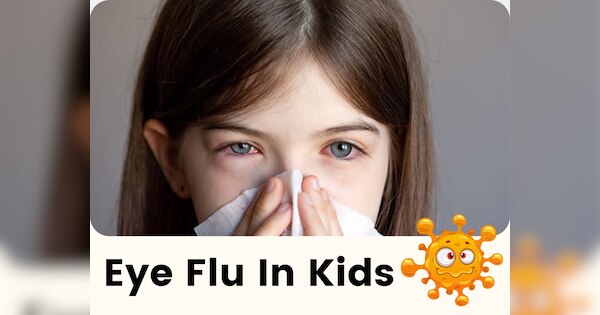 Eye flu treatment children may get fever due to conjunctivitis keep ...