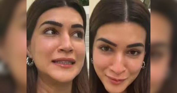 Kriti Sanon swollen face Seeing trollers asked Did you get Botox done ...