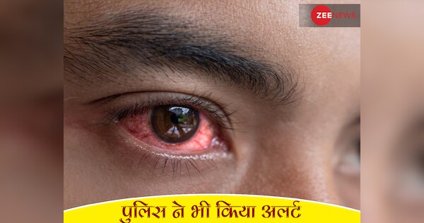 Eye Flu: Delhi Police also alerts who have red-pink eyes try remedy | Eye Flu से सावधान! पुलिस ...